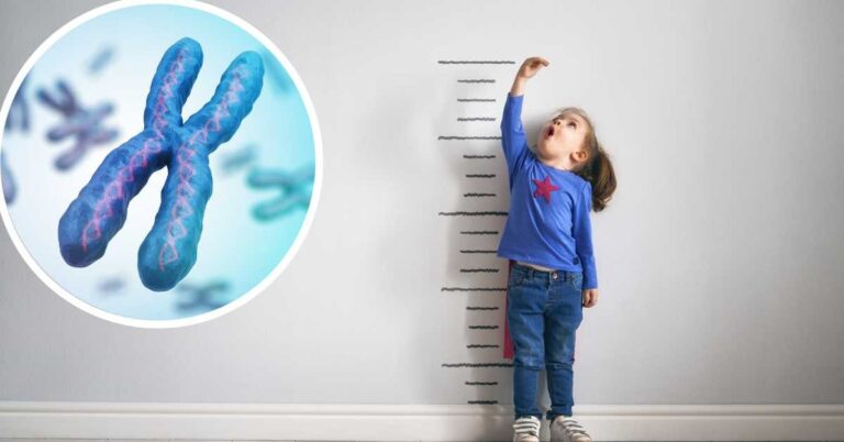 Síndrome de Turner - CDN