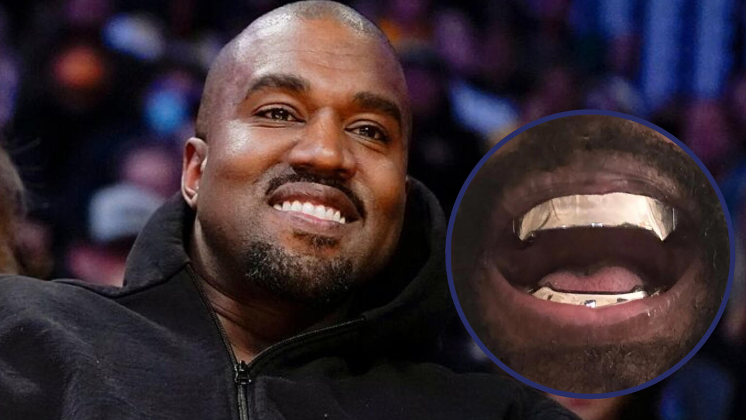 Kanye West estrena sonrisa de titanio ¡no creerás el monto!