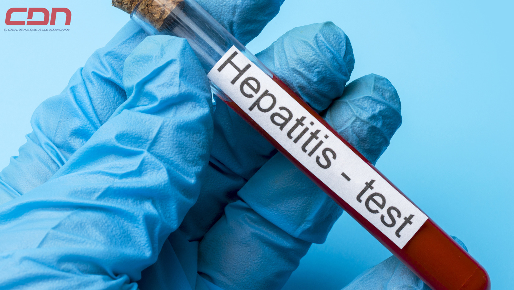 OMS precalifica el primer autotest para la hepatitis C