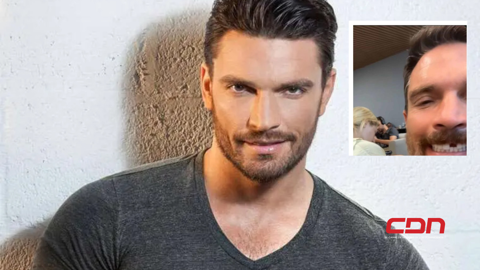 Actor Julián Gil pierde un diente