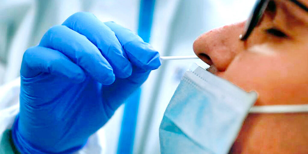 Baja el número de muestras diagnósticas del covid-19
