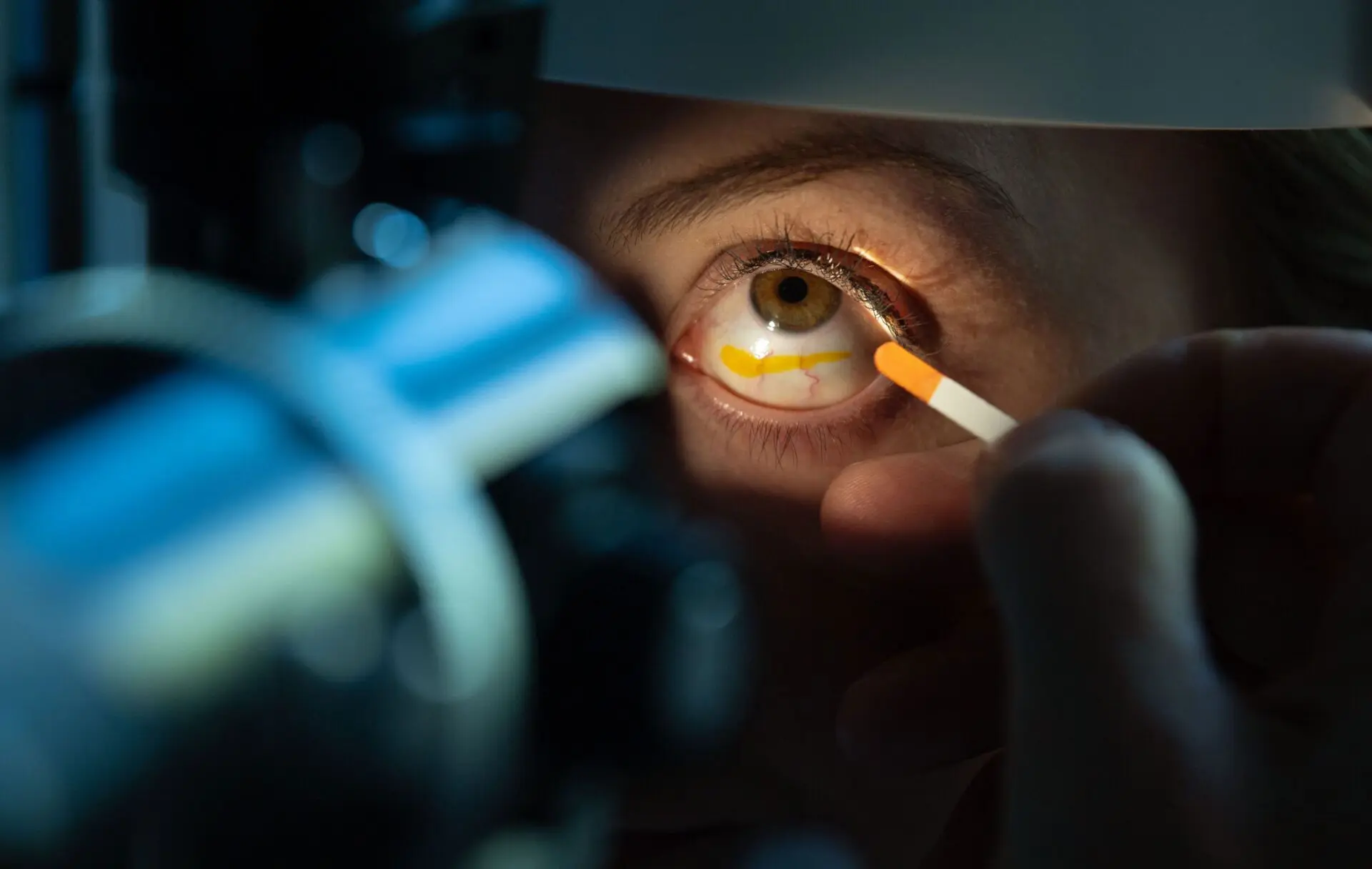 Glaucoma Segunda Causa Común De La Ceguera