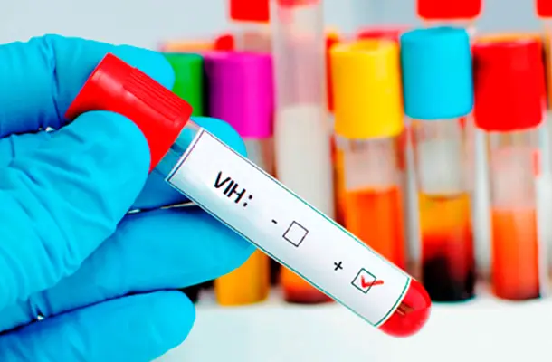 Avance para mejorar los diagnósticos de VIH